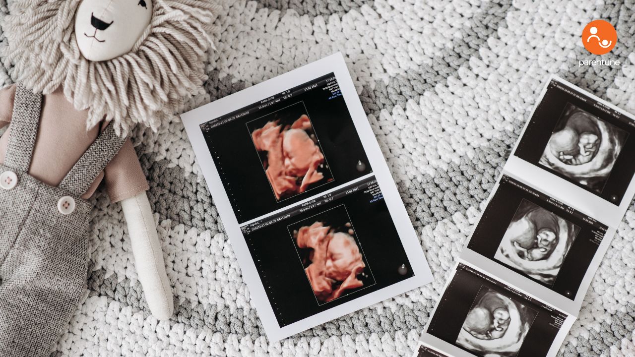 What A 6-Week Fetus Looks Like: Development, Size & Ultrasound Guide